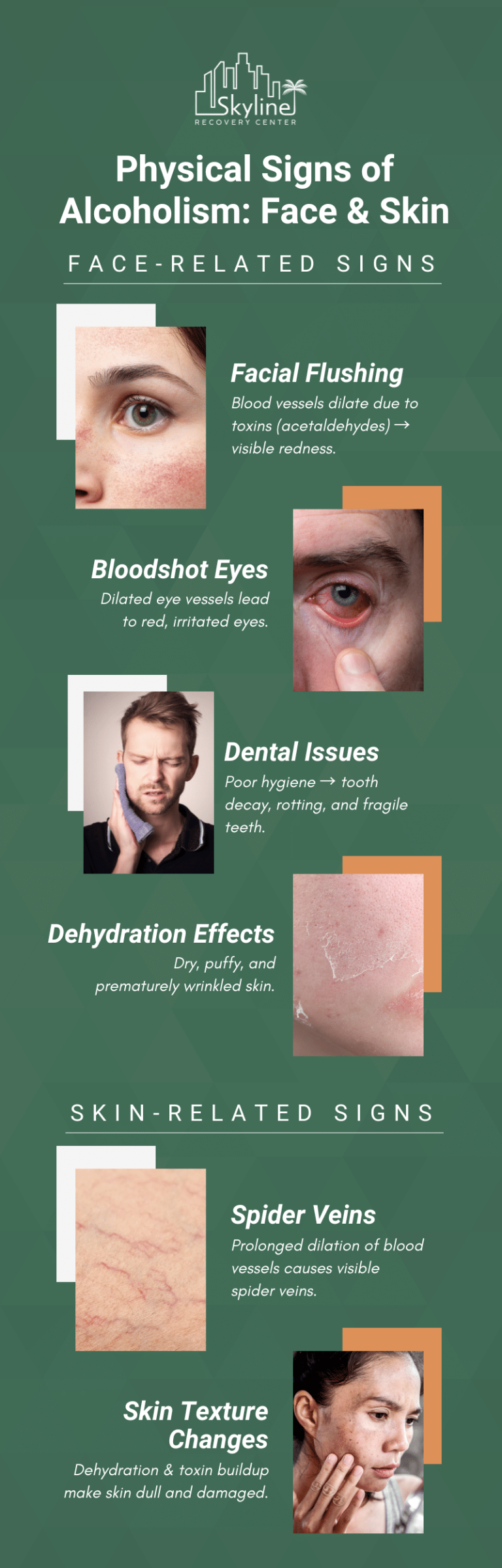 Physical Signs of Alcoholism: What Your Body Reveals
